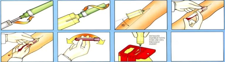 The Complete Guide to Professional Blood Collection Techniques ...